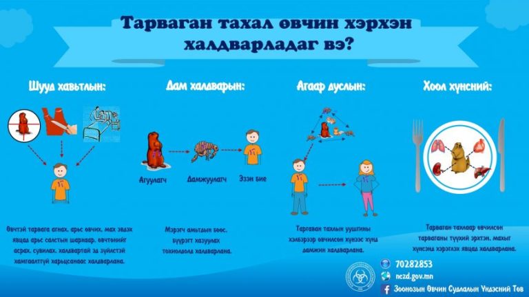 Хэвтүүлэн эмчлэх тусламж үйлчилгээ Багахангай дүүргийн эрүүл мэндийн төв